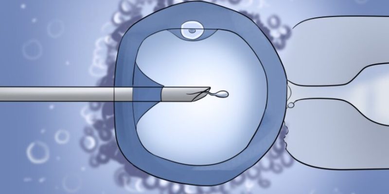 Everything You Need to Know About the ICSI Procedure